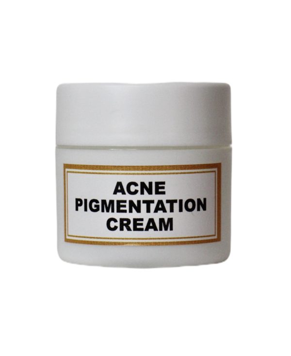 Acne Pigmentation cream - 50ml - Skin Care Essentials